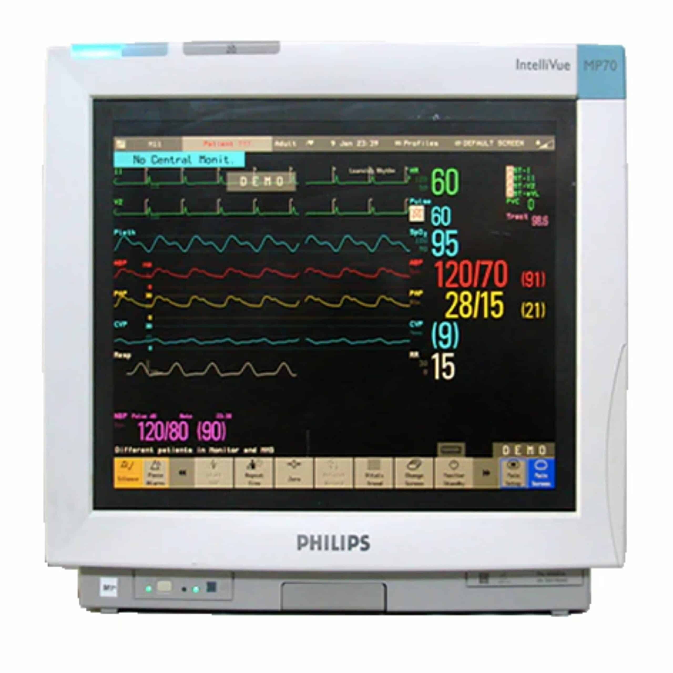 Patient Monitors - IPR Medical